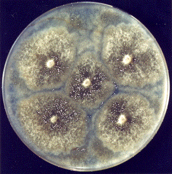 Podospora anserina (strain S / ATCC MYA-4624 / DSM 980 / FGSC 10383 ...